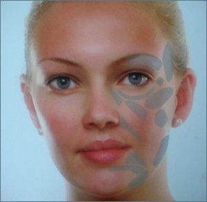 Facial Lipo-Injection - Luisa Plata